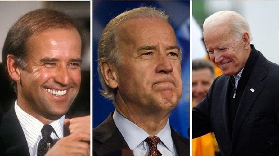 Joe Biden Plastic Surgery Before After